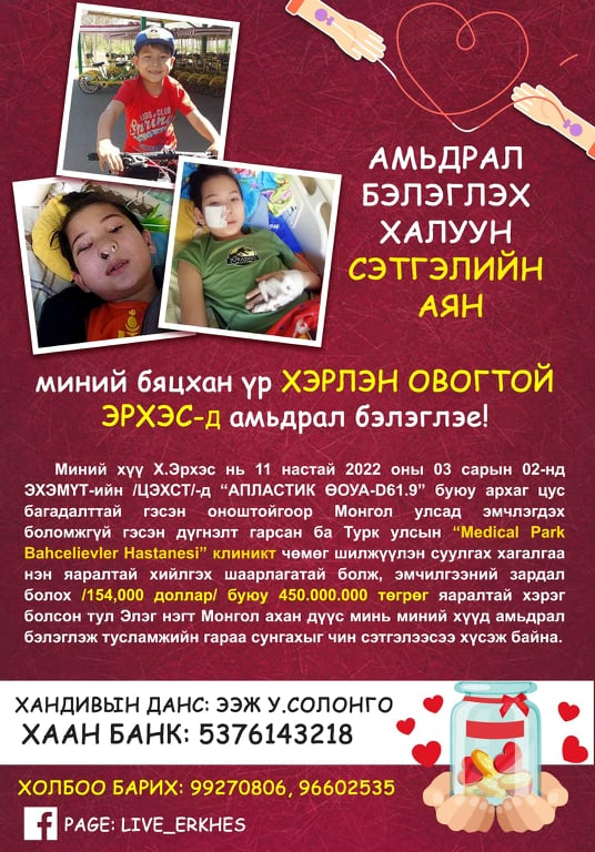 ХЭРЛЭН ОВОГТОЙ ЭРХЭС ХҮҮД АМЬДРАЛ БЭЛЭГЛЭХ ХАЛУУН СЭТГЭЛИЙН АЯНД ЭРХЭМ