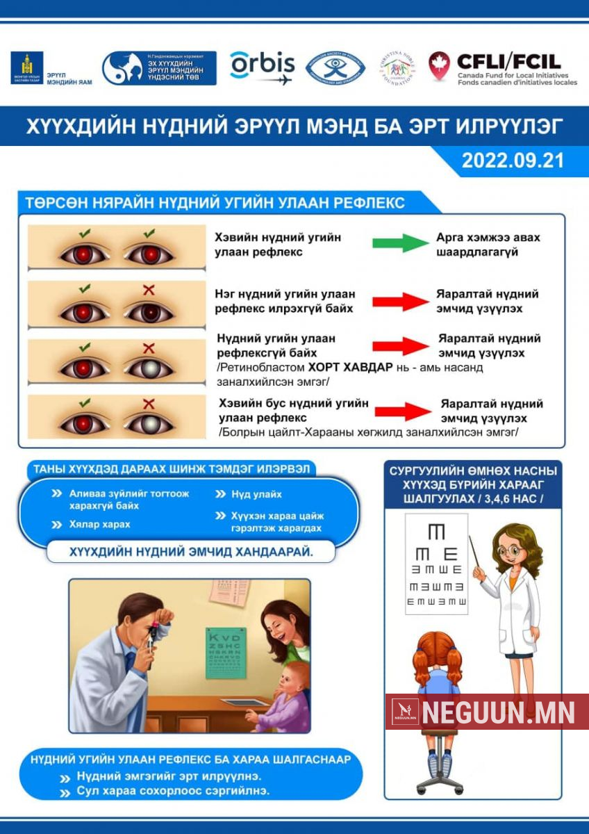 ХҮҮХДИЙН НҮДНИЙ ЭРҮҮЛ МЭНД БА ЭРТ ИЛРҮҮЛЭГ Neguun Mn Мэдээллийн анхдагч бодит эх сурвалж